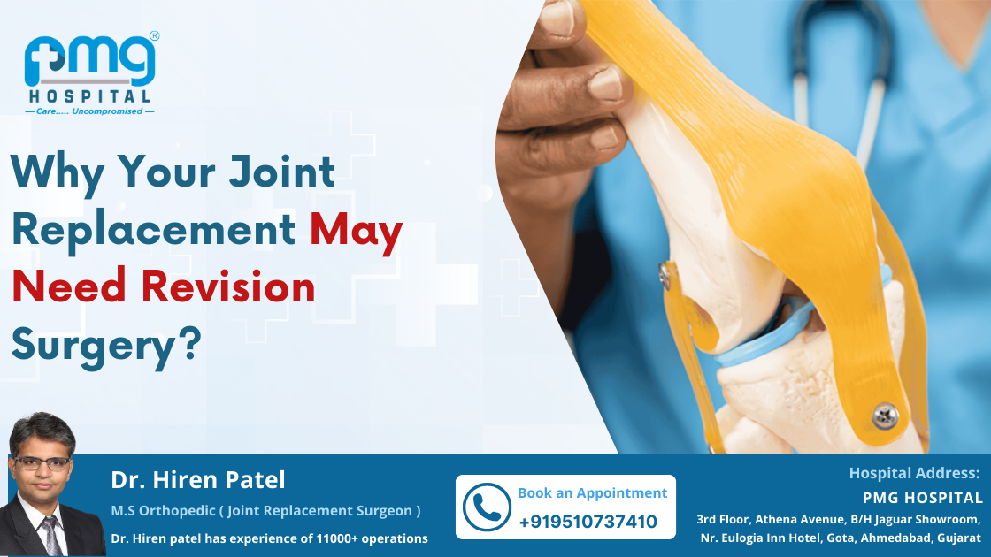 Why Your Joint Replacement May Need Revision Surgery
