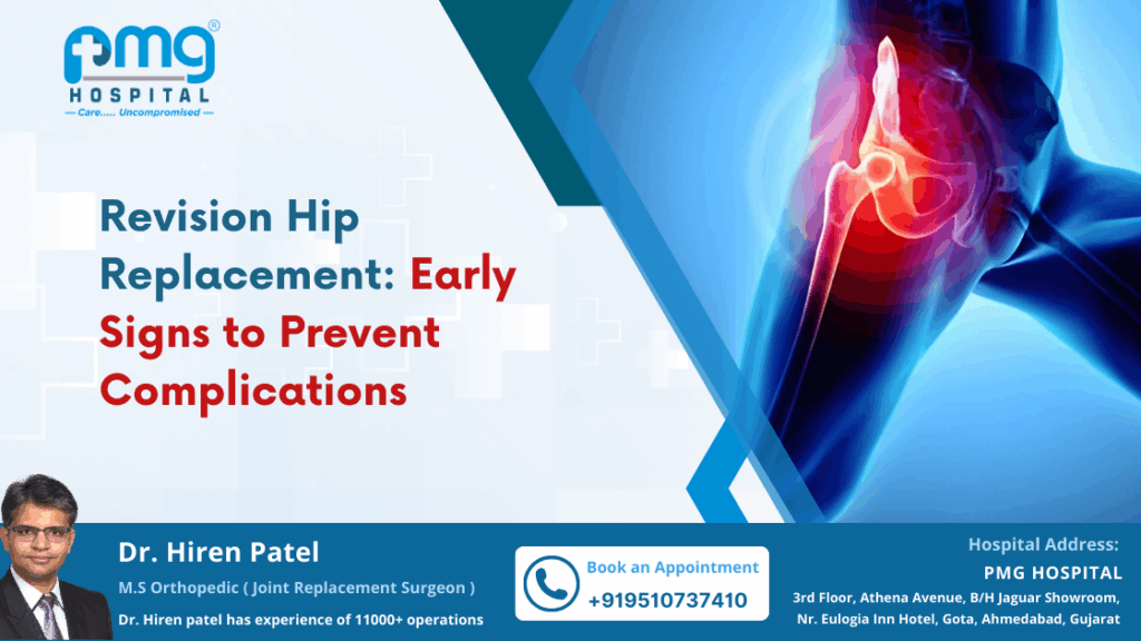 Revision Hip Replacement: Early Signs to Prevent Complications
