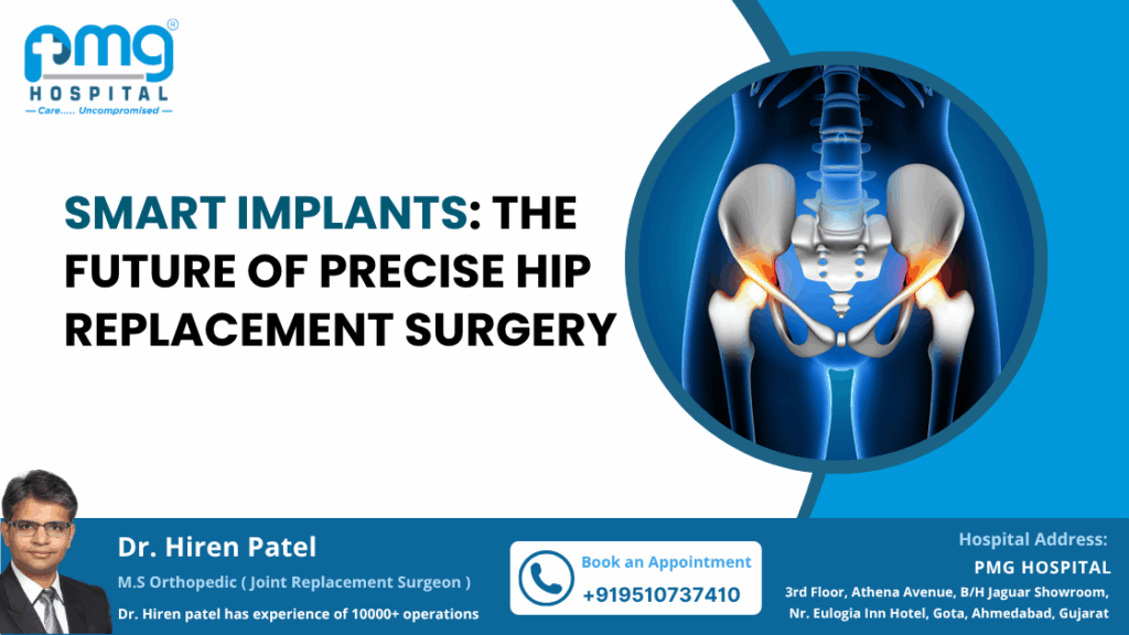 Smart Implants: The Future of Precise Hip Replacement Surgery
