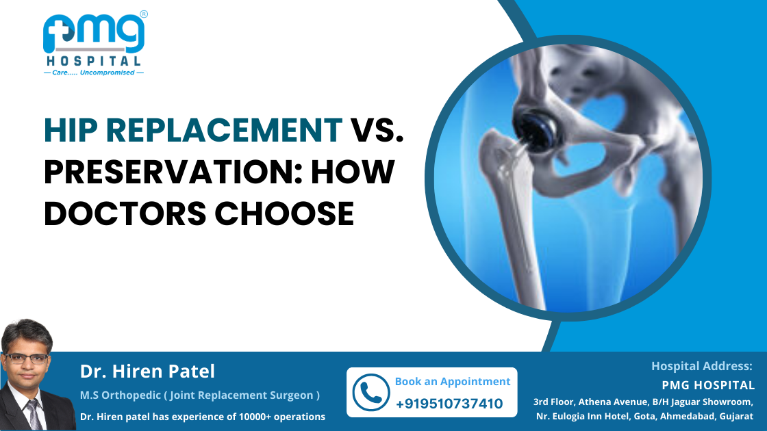 Hip Replacement vs. Preservation: How Doctors Choose