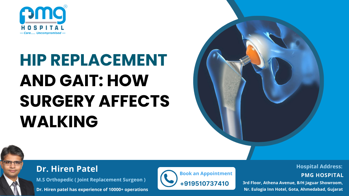 Hip Replacement and Gait: How Surgery Affects Walking
