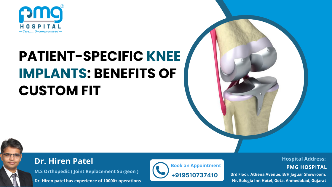 Patient-Specific Knee Implants: Benefits of Custom Fit