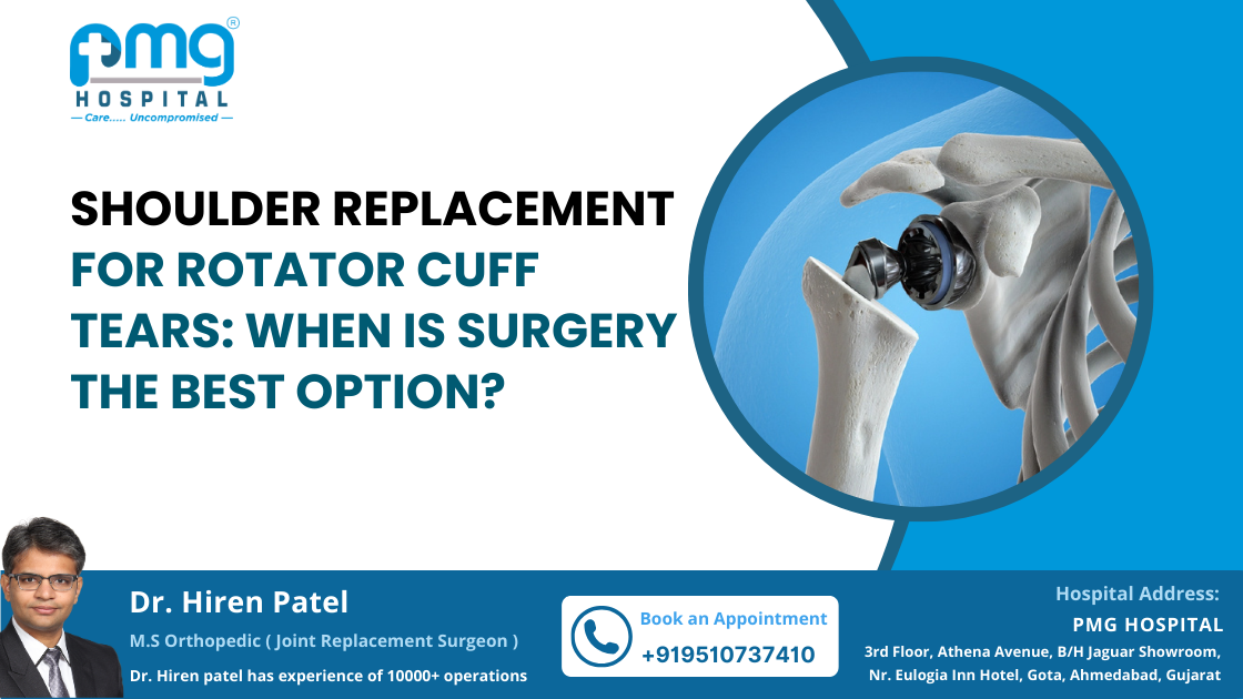 Shoulder Replacement for Rotator Cuff Tears