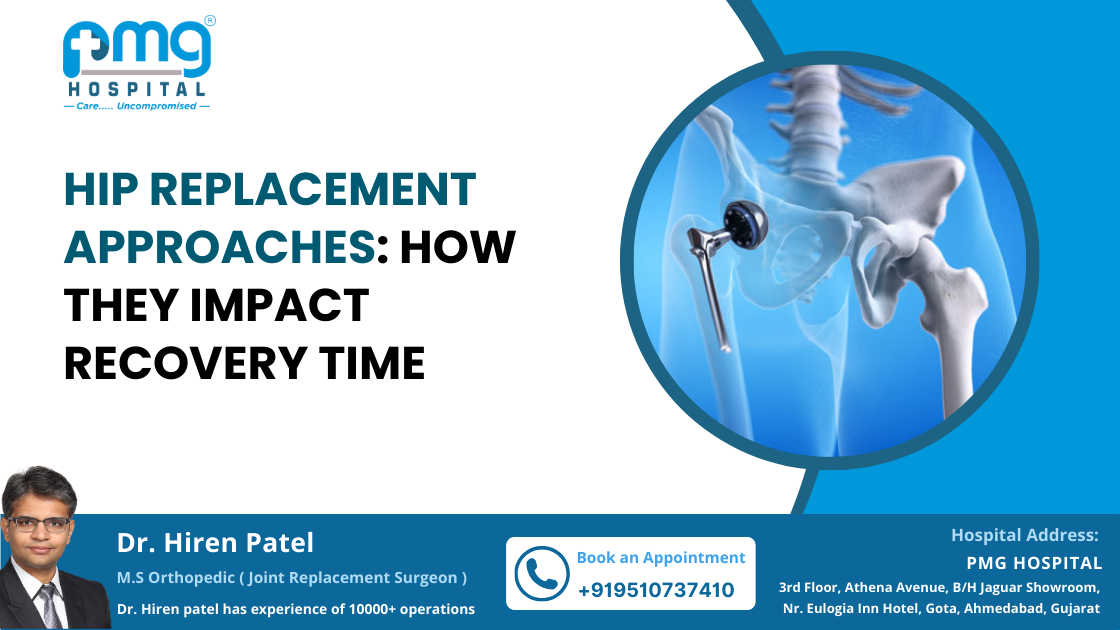 Hip Replacement Approaches: How They Impact Recovery Time